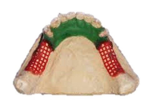 Plastic RPD Patterns - Coming Soon! – Consolidated Metal Products